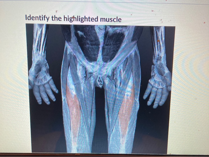 Solved Identify the highlighted muscle TU | Chegg.com