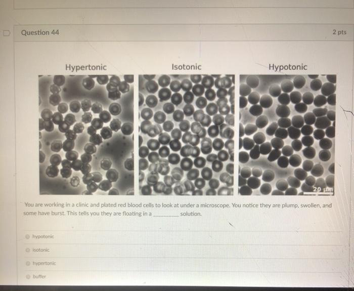 Solved Question 44 2 pts Hypertonic Isotonic Hypotonic 20 L | Chegg.com