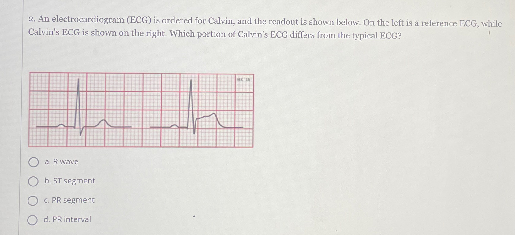 Solved An electrocardiogram (ECG) ﻿is ordered for Calvin, | Chegg.com