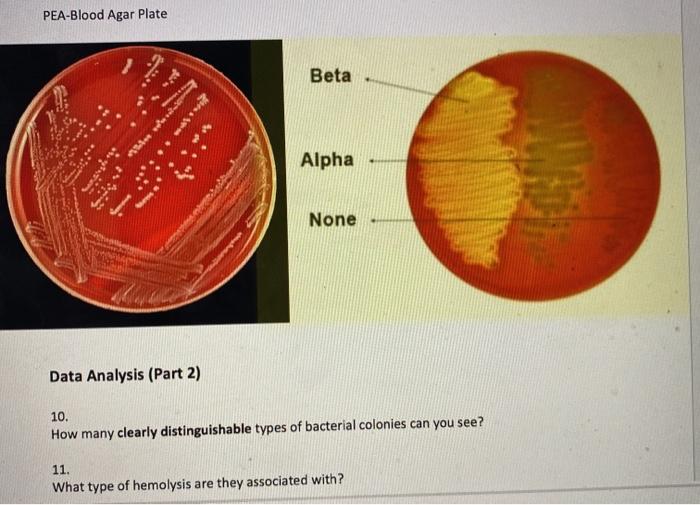Solved PEA-Blood Agar Plate Beta Alpha None Data Analysis | Chegg.com