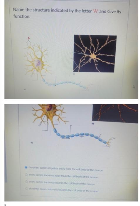 Solved Identify the structure at the tip of the pointer and | Chegg.com