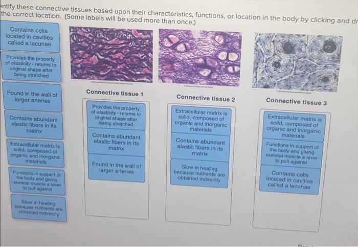 Solved entify these connective tissues based upon their | Chegg.com