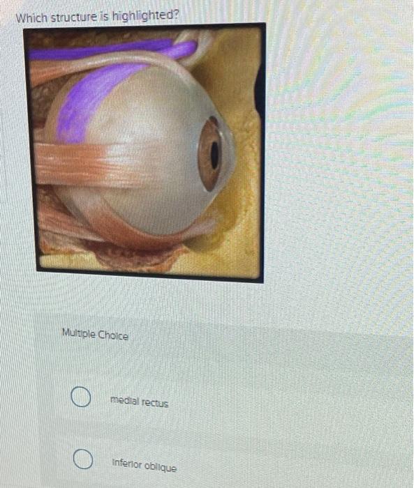 Solved Which structure is highlighted? Multiple Choice | Chegg.com