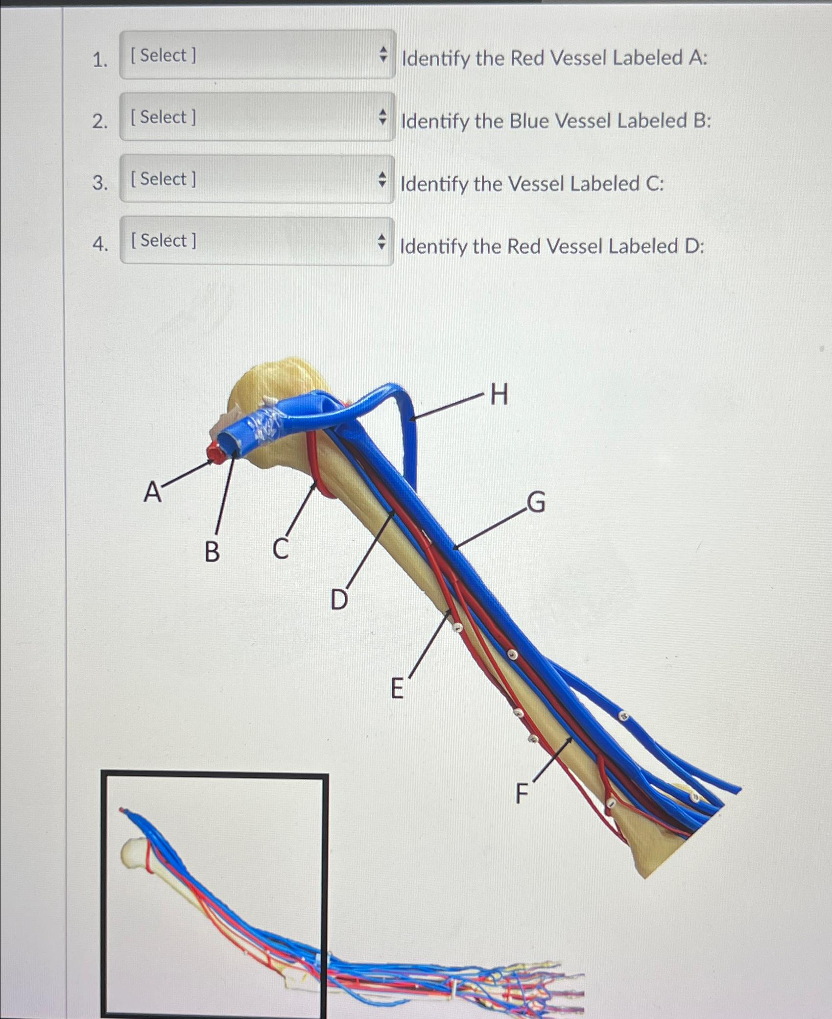 Solved Identify the Red Vessel Labeled A:Identify the Blue | Chegg.com