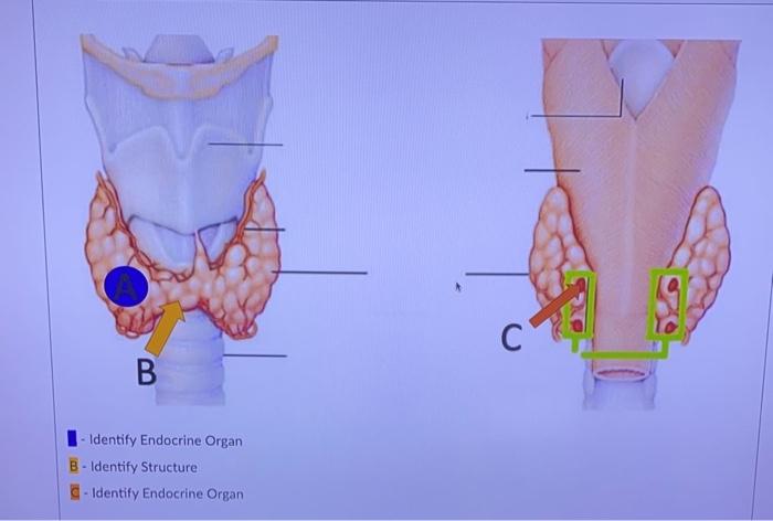 Solved С B Identify Endocrine Organ B - Identify Structure - | Chegg.com
