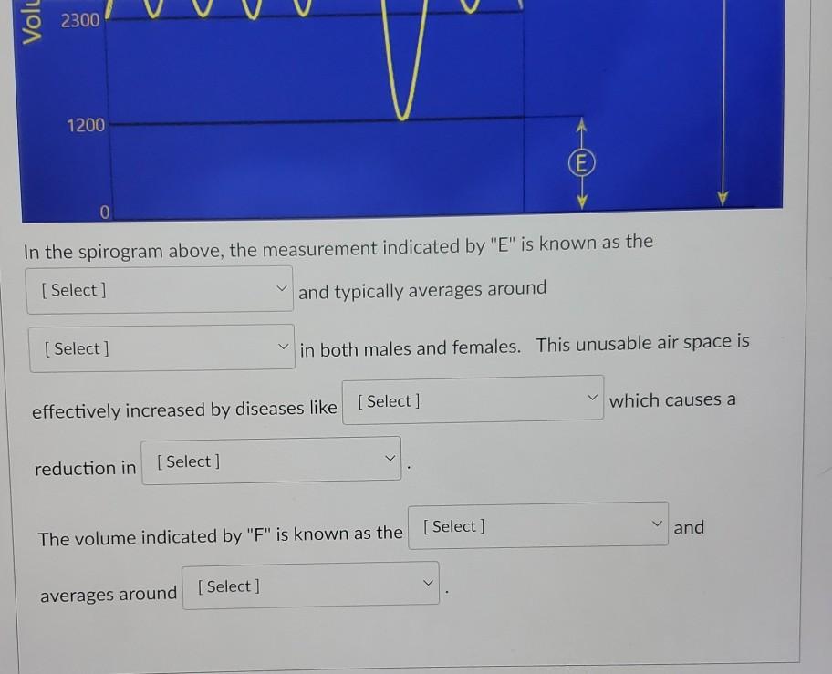 Solved 5800 2800 F n 2300 m 1200 E 0 In the spirogram above, | Chegg.com