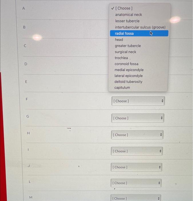 A [Choose] 4 B [Choose] C [Choose] D [ Choose] EF | Chegg.com