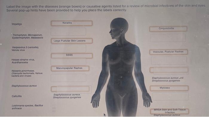 Label the image with the diseases (orange boxes) or | Chegg.com