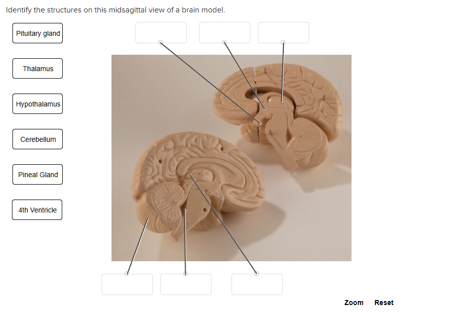 Solved Identify the structures on this midsagittal view of a | Chegg.com