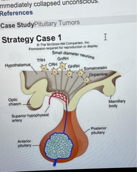 Solved Case study 8 Pituitary Tumors Aim to Please Read the | Chegg.com