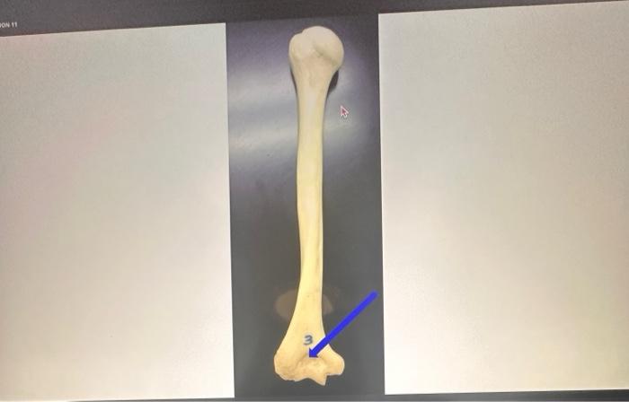 Solved identify the indention on bone that arrow is pointing | Chegg.com
