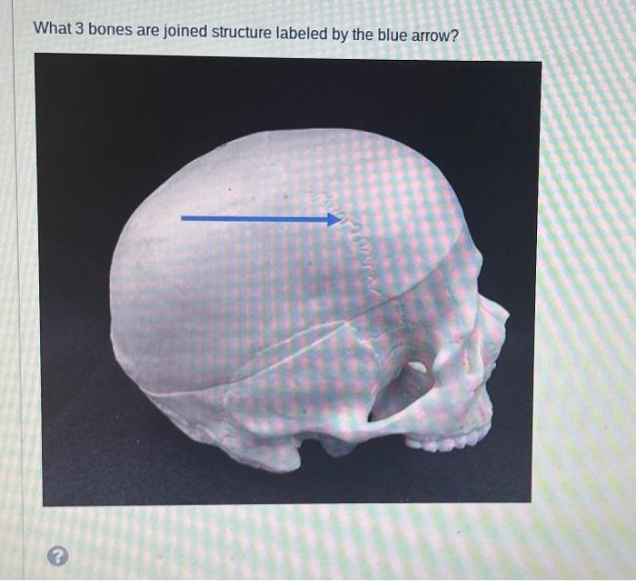 Solved What 3 bones are joined structure labeled by the blue | Chegg.com