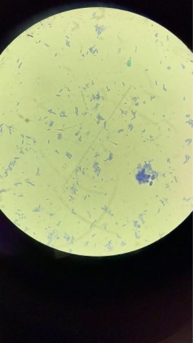 Using the Simple stain technique, can you distinguish | Chegg.com