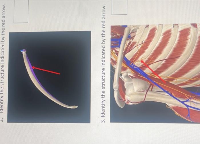 Solved 2. Identify the structure indicated by the red arrow. | Chegg.com