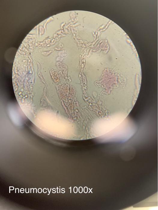 Solved Penicillium 1000x Saccharomyces