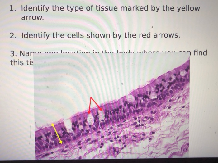 Solved 1. Identify the type of tissue marked by the yellow | Chegg.com