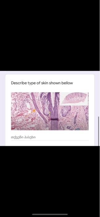 Solved Describe type of skin shown bellow თქვენი პასუხი | Chegg.com