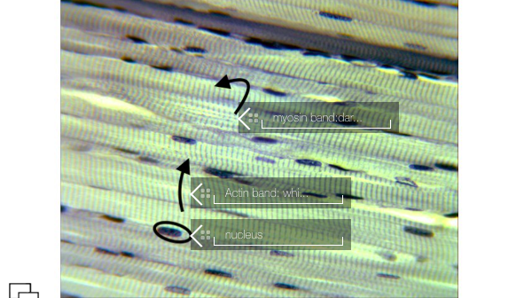 Solved Label a nucleus, an actin band, and a myosin band. Am | Chegg.com