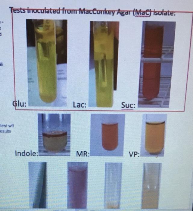 Solved Tests inoculated from MacConkey Agar (Mac) isolate: | Chegg.com