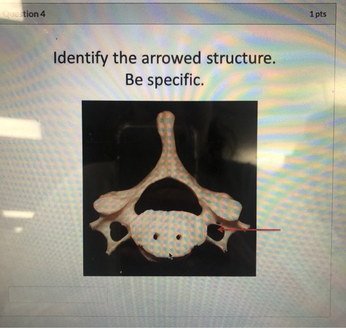 Solved uestion 1 1 pts Identify the arrowed structure. Be | Chegg.com Solved uestion 1 1 pts Identify the arrowed structure. Be | Chegg.com
