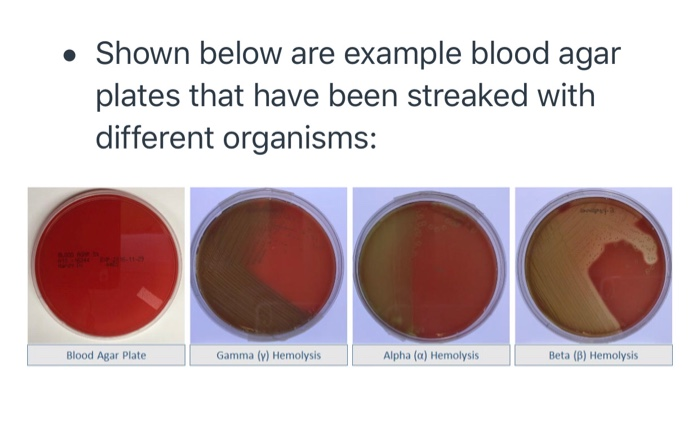 Solved Helga DX Description E.coli Tose to magenta colonies | Chegg.com
