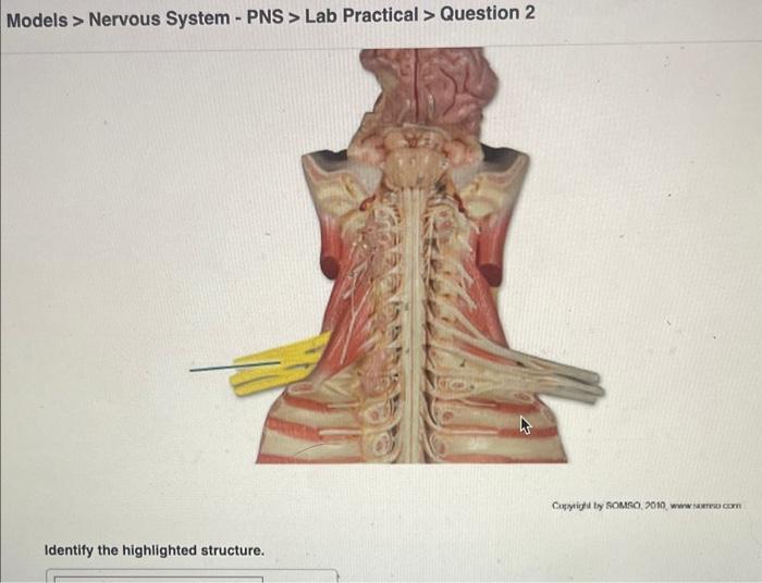 Solved Models > Nervous System - PNS > Lab Practical > | Chegg.com