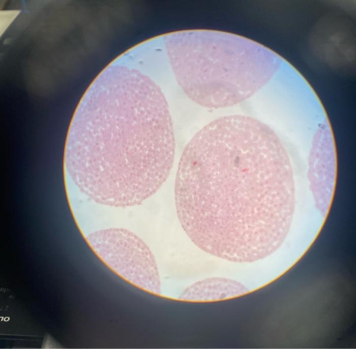 Solved What forms of mitosis are going on here? Please | Chegg.com