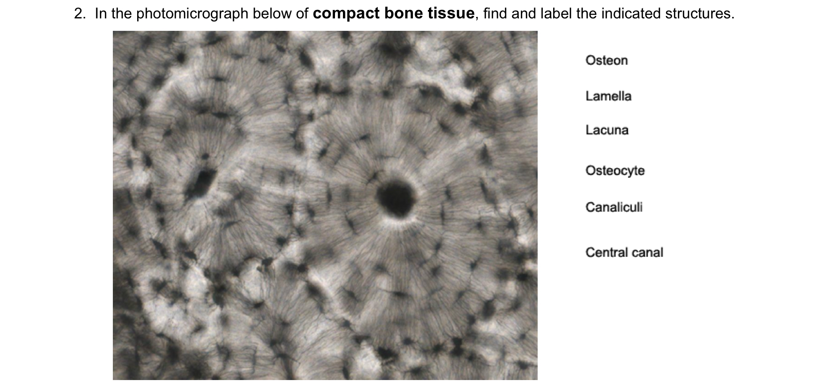 Solved In the photomicrograph below of compact bone tissue, | Chegg.com