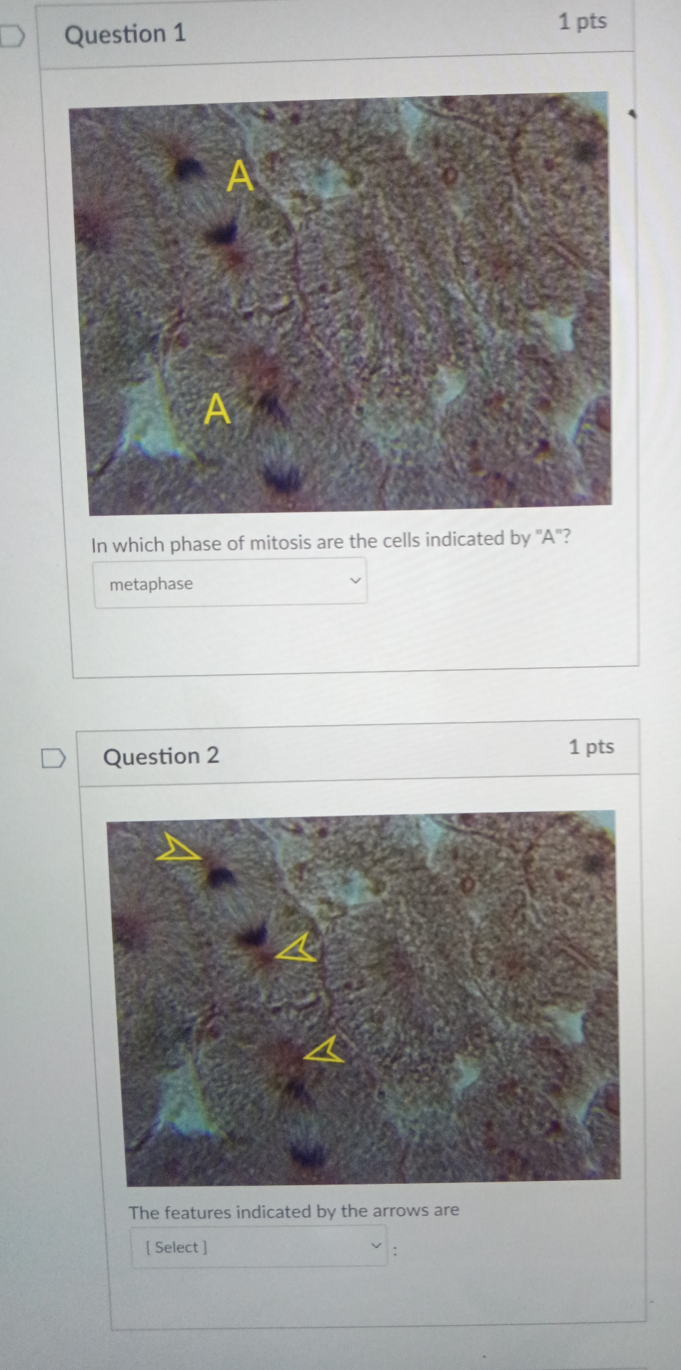 Solved Question 11 ﻿ptsIn which phase of mitosis are the | Chegg.com