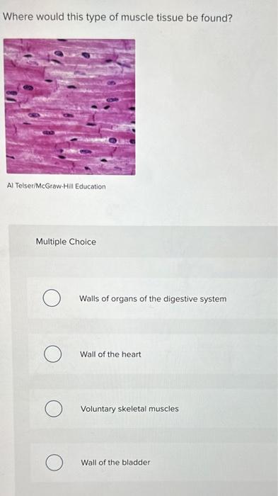 Solved Where would this type of muscle tissue be found? Al | Chegg.com