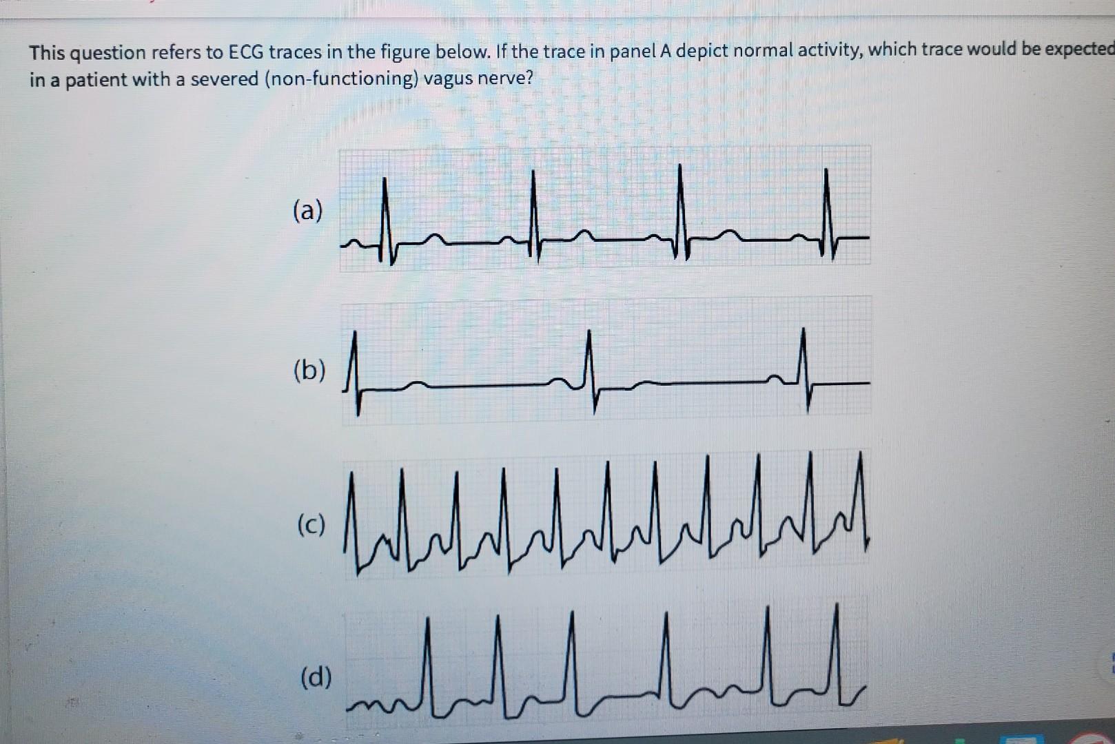 Solved This question refers to ECG traces in the figure | Chegg.com
