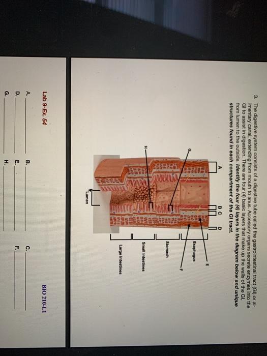 Solved 3. The digestive system consists of a digestive tube | Chegg.com