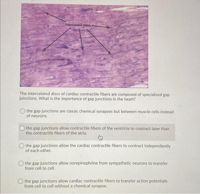 Solved Intercalated disko The intercalated discs of cardiac | Chegg.com