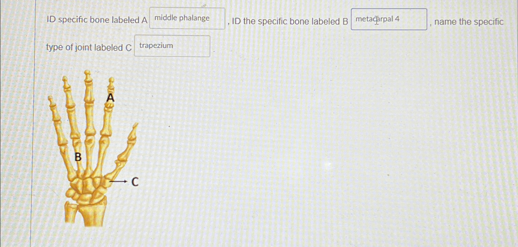 ID specific bone labeled A middle phalange , ﻿ID the | Chegg.com