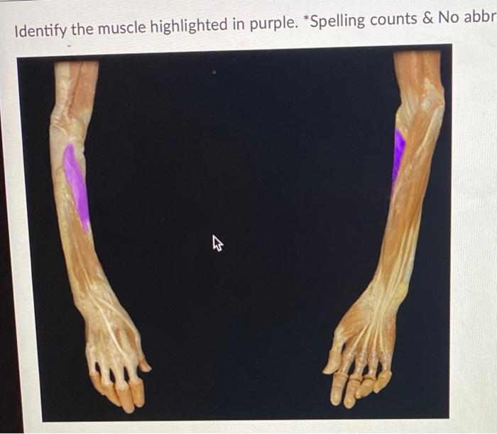 Solved Identify the muscle highlighted in purple. *Spelling | Chegg.com