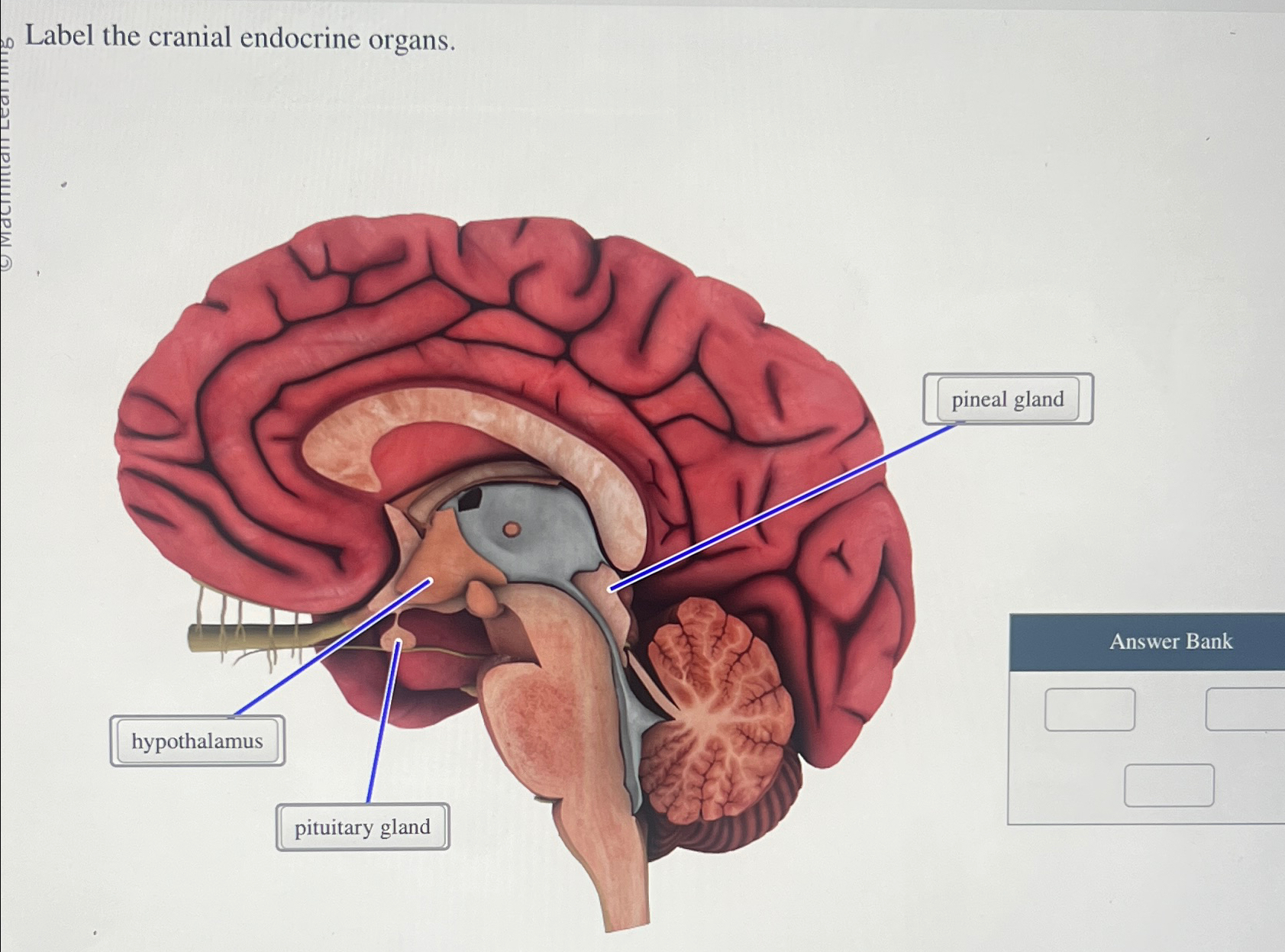 Solved Label the cranial endocrine organs. | Chegg.com Solved Label the cranial endocrine organs. | Chegg.com