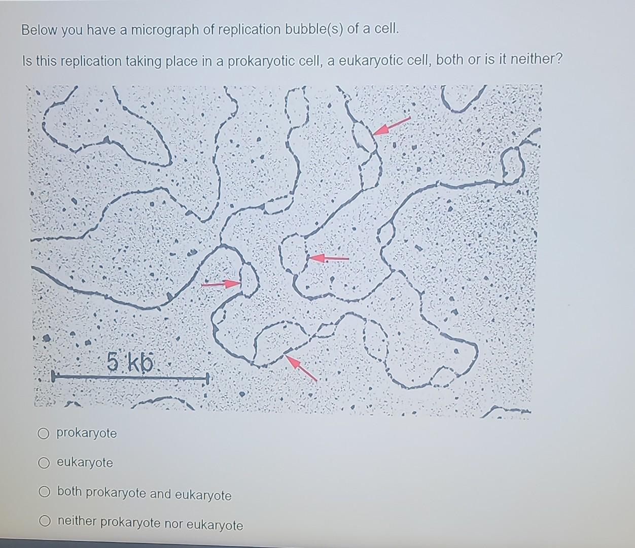 Solved Below you have a micrograph of replication bubble(s) | Chegg.com