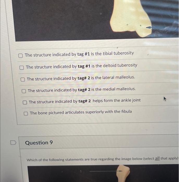 Solved Which of the following statement are true regarding | Chegg.com