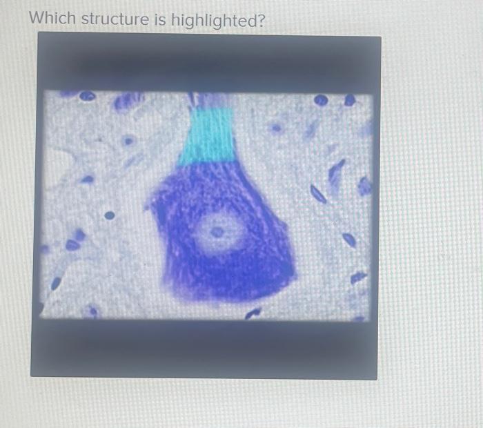 Solved Which structure is hiahliahted? Multiple Choice | Chegg.com