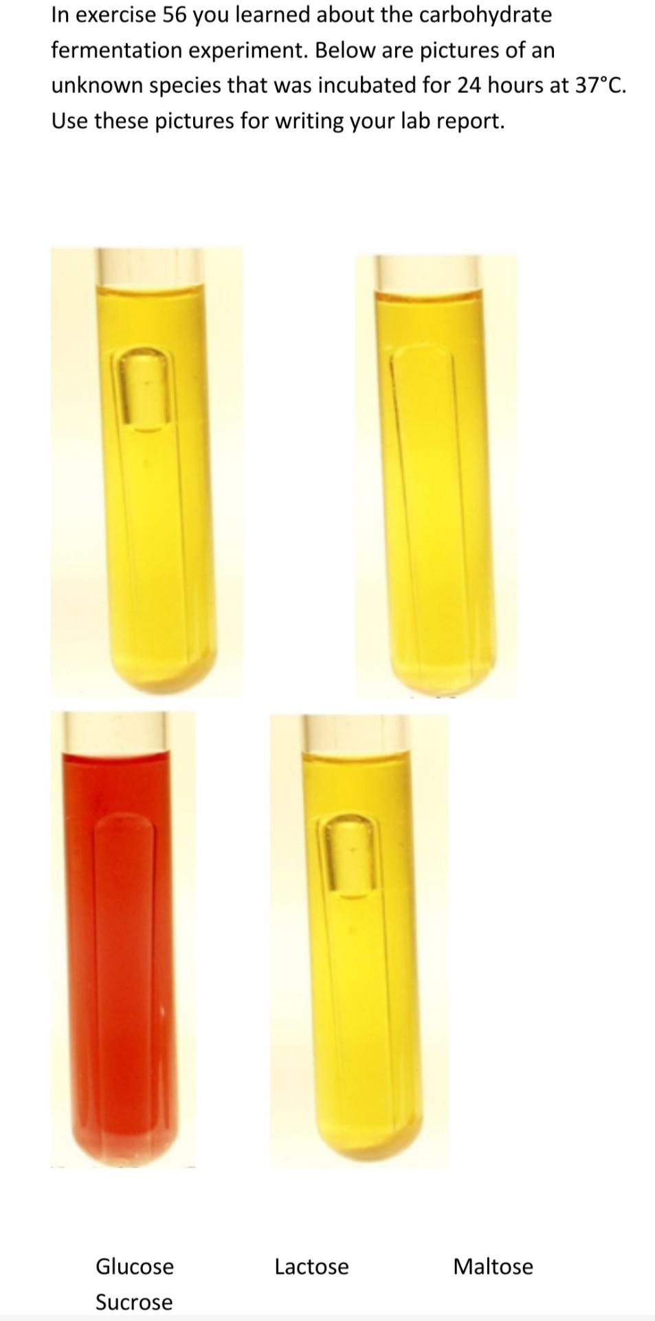 Solved In exercise 56 you learned about the carbohydrate | Chegg.com