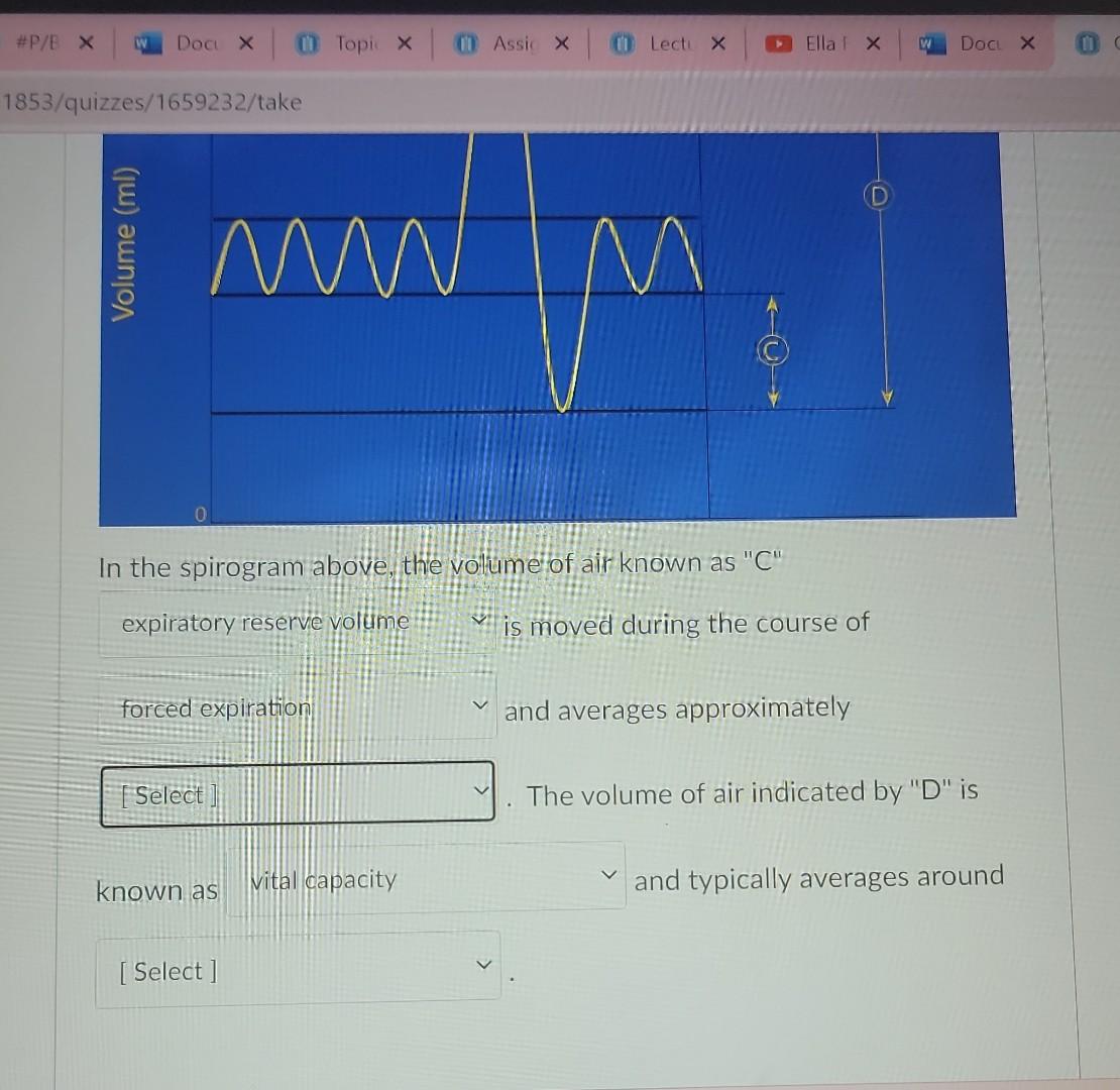 Solved In The Spirogram Above The Vollume Of Air Known As