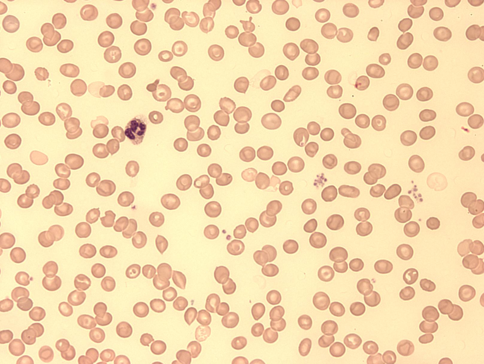 Solved For each smear, 1) ﻿Describe the morphology seen, 2) | Chegg.com