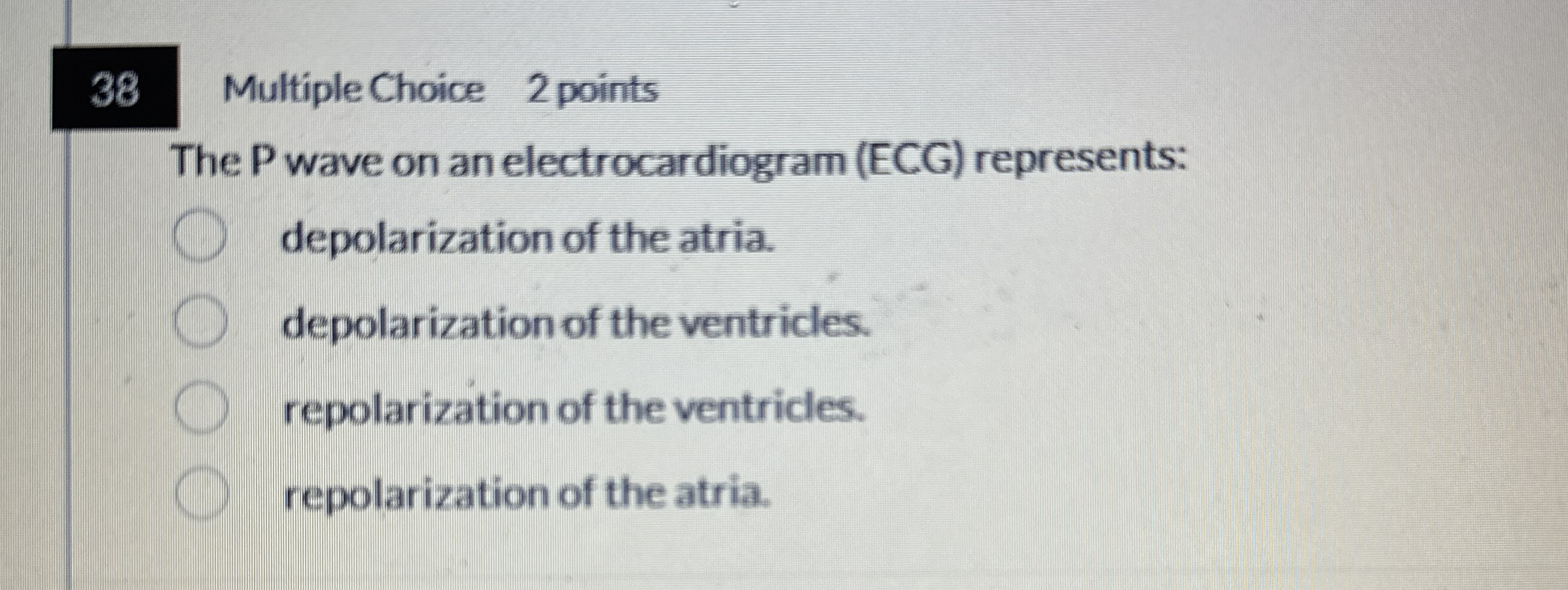 Solved 38Multiple Choice 2 ﻿pointsThe P ﻿wave on an | Chegg.com