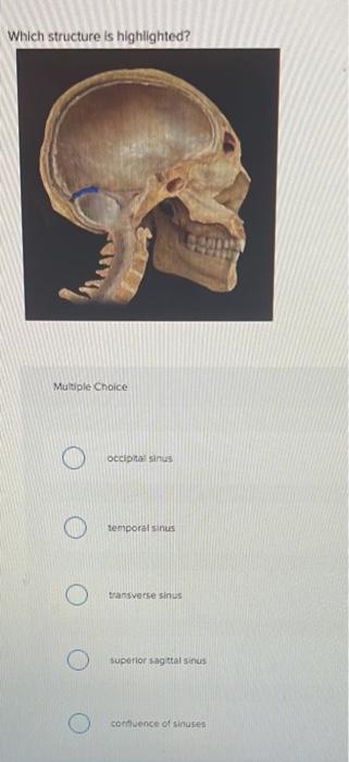 Solved Which structure is highlighted? Multiple Choice O | Chegg.com