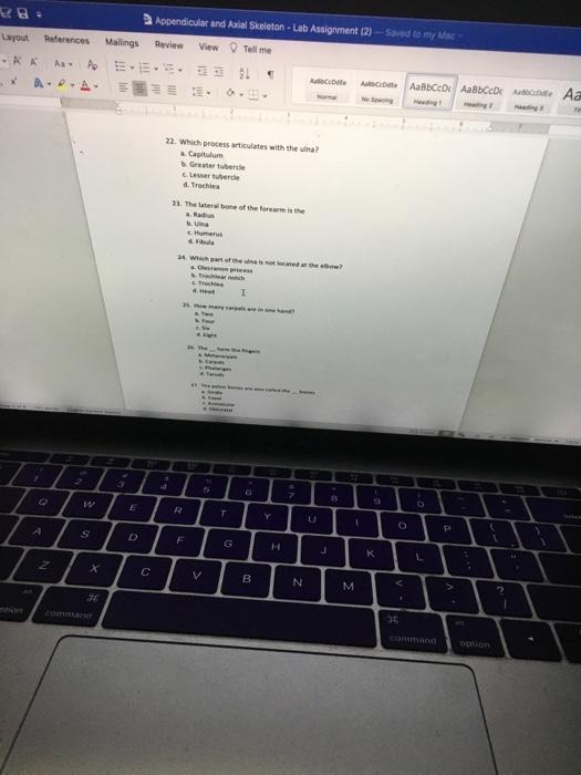 Solved CB Appendicular and Axial Skeleton-Lab Assignment (2) | Chegg.com