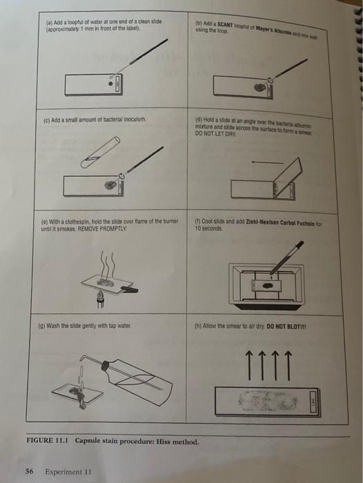 Solved EXPERIMENT 11 Capsule Stain-Hiss Method Photo 918 | Chegg.com