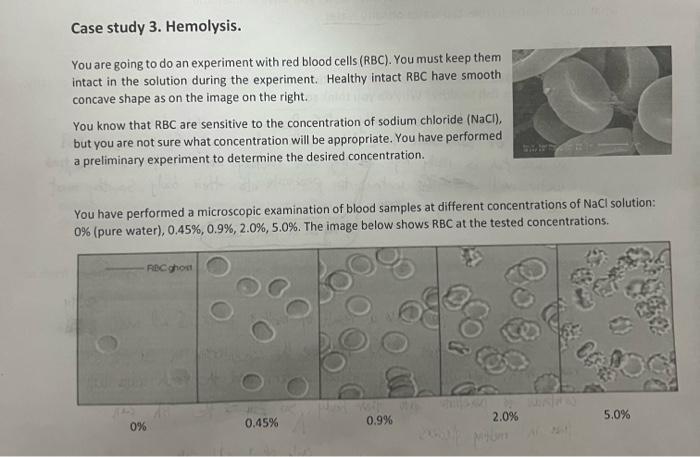 Solved You are going to do an experiment with red blood | Chegg.com