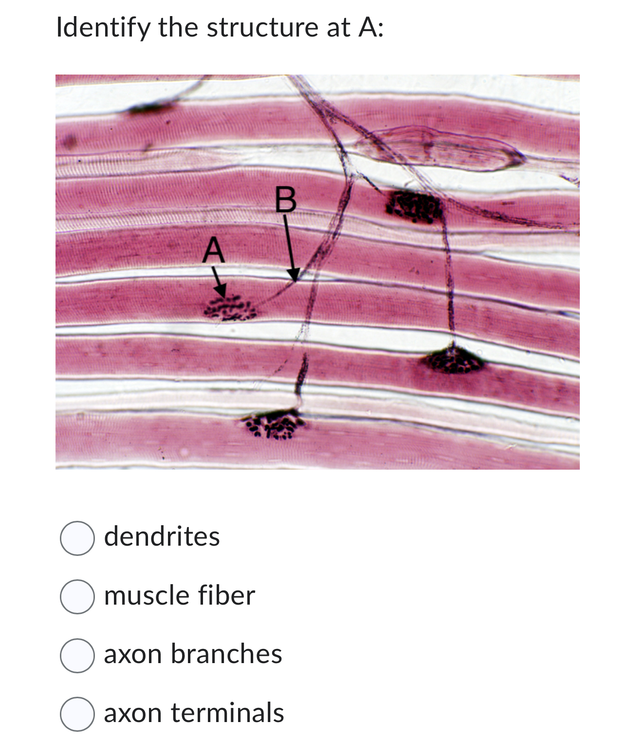 Solved Identify the structure at A ﻿:dendritesmuscle | Chegg.com