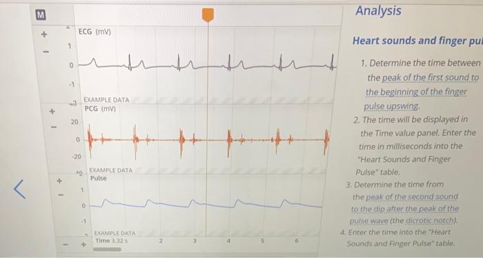 Solved M Analysis + ECG (mv) Heart sounds and finger pu 1 . | Chegg.com