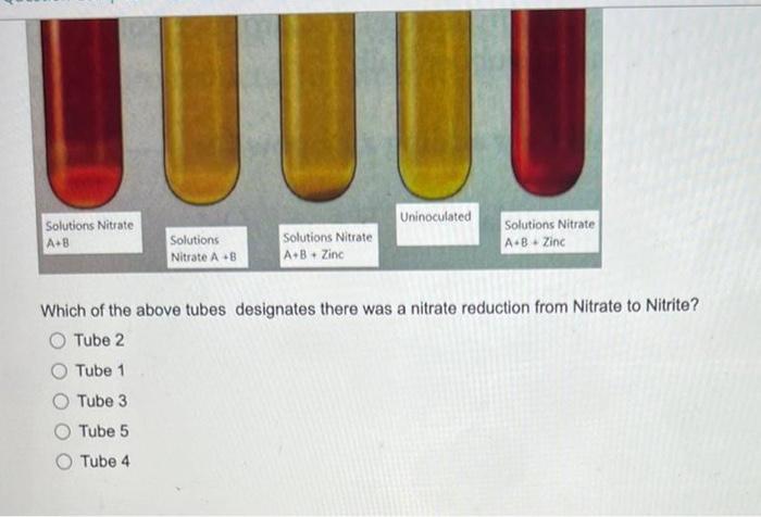 Solved Which of the above tubes designates there was a | Chegg.com